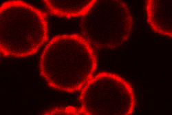 UPENN || SOM || Center for Clinical Immunology || Home